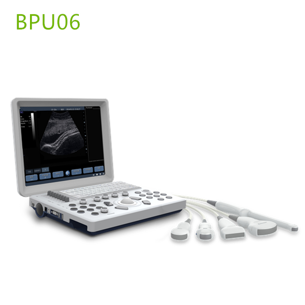 Ultrasound Machines-Light weight and Excellent Performance ultrasound ...